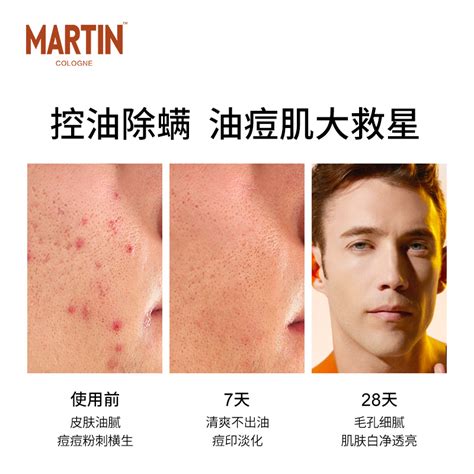 马丁进口海盐香皂磨砂除螨皂洗脸沐浴全身背面部亮肤祛痘男去螨虫虎窝淘