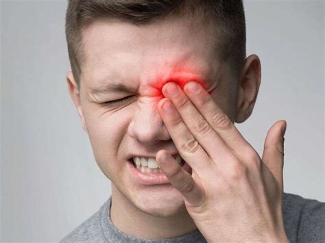 Uveitis 10 Uveitis Symptoms