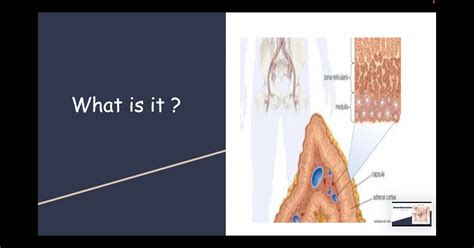 Pechakucha Presentation Adrenal Hyperfunction