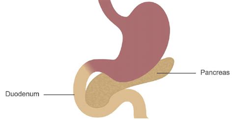 Abdominal Ct Small Intestine • Litfl • Radiology Library