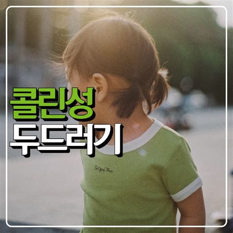 아동 콜린성두드러기 Vs 한랭두드러기 증상과 원인 치료 알러지 알레르기 네이버 블로그