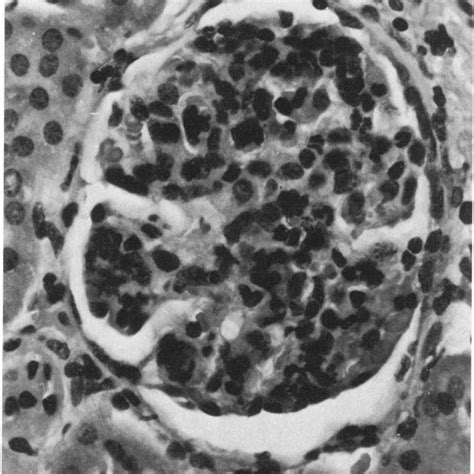 Direct Immunofluorescence Photomicrograph Of A Glomerulus From A Swiss Download Scientific