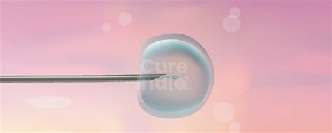 ICSI IVF ICSI Treatment ICSI Success Rate