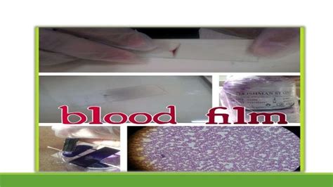 Stain Of Hematology