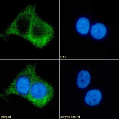 Beta 2 Adrenergic Receptor Chimeric Recombinant Rabbit Monoclonal