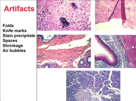 Vibs Intro Epithelium Flashcards Quizlet