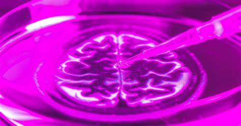 Scientists Are Growing Brains In Labs Could They Become Conscious