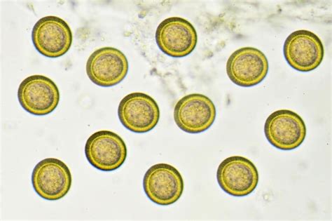 Premium Photo Eggs Of Taenia In Stool Analyze By Microscope