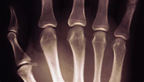 Activity With The Fibonacci Sequence Sciencing