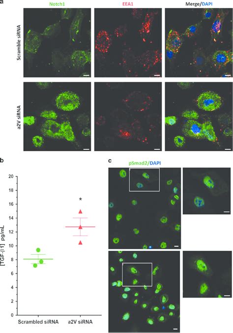 Small Interfering Rna Sirna Mediated Knockdown Of A2v In Hmepcs Leads