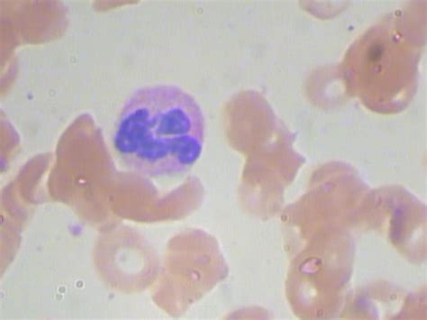 Bccd Dataset V0 Object Detection Dataset By Prutengiz