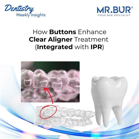 How Buttons Enhance Clear Aligner Treatment Integrated With Ipr Mr Bur