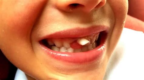 The Loose Tooth YouTube