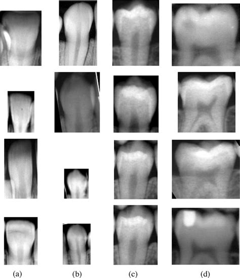 Sample Of Teeth Used In Constructing The Image Subspaces Of The Four Download Scientific