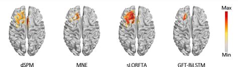 Figure 10 From A Graph Fourier Transform Based Bidirectional Long Short Term Memory Neural