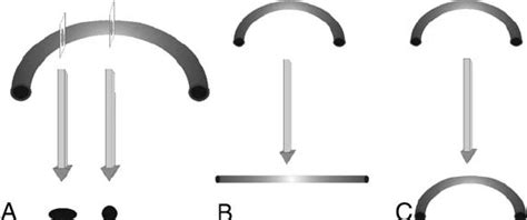 The Rigid And Or Affine Linear Registration Methods May Affect The Download Scientific