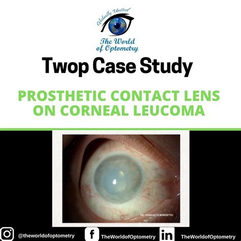 The World Of Optometry On Linkedin Twop Theworldofoptometry