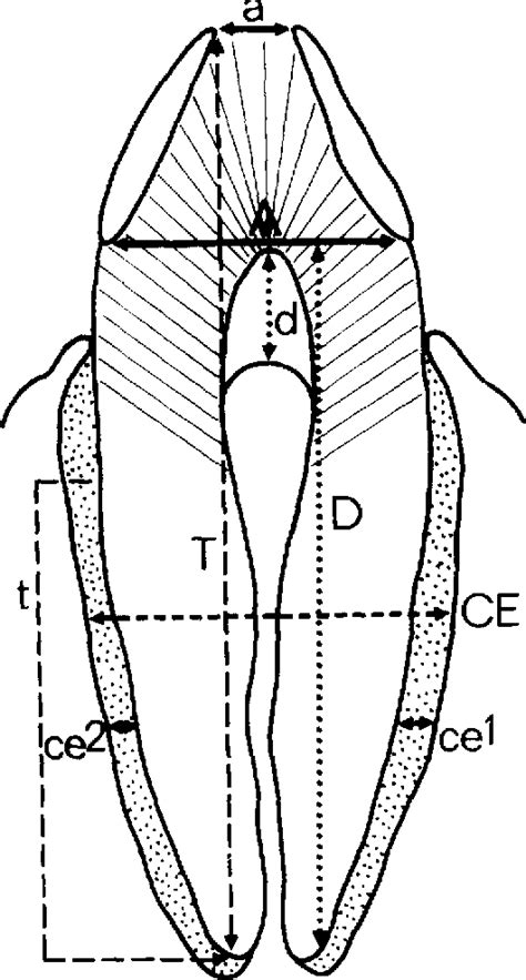 Figure 2 From A Modified Gustafson Method Of Age Estimation From Teeth