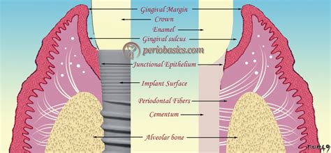 Biological Aspect Of Dental Implants