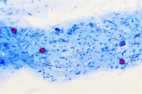 Cryptosporidium A Nightmare In The Making Canadian Cattlemen