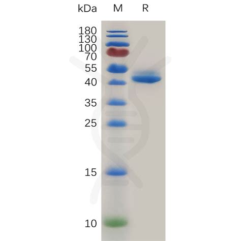 Mouse Gitr Ligand Protein Hfc Tag 专注肿瘤免疫