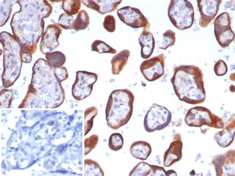 Glypican 3 Gpc3 Hepatocellular Carcinoma Marker Recombinant