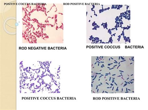Isolation Of Protease Producing Microorganism Pptx Gardening Home