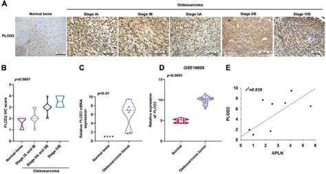 A Positive Correlation Between Apln And Plod2 Expression In Human