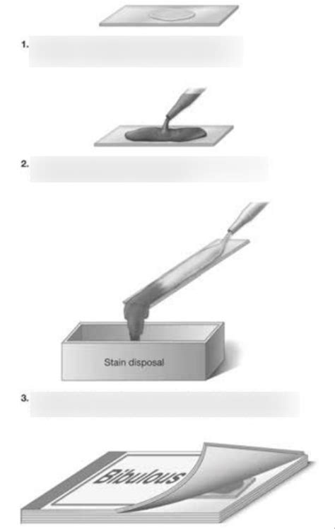 Simple Stain Procedure Diagram Quizlet