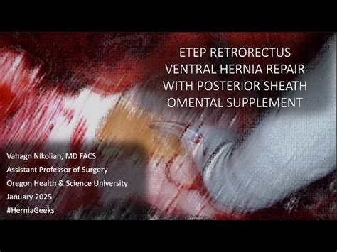 Ventral Hernia 55 Etep Retrorectus With Posterior Omental Supplement Behind The Knife The