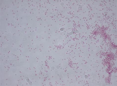 Gram Negative Bacilli Rods Microbiology Learning The Why Ology Of Microbial Testing
