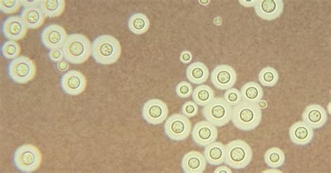 곰팡이 질환 기후위기로 생존력 높아져