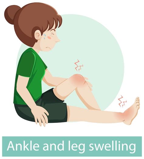 Ankle Swelling Examples Vectors And Illustrations For Free Download