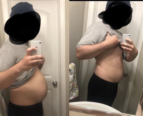 Ibs Bloating