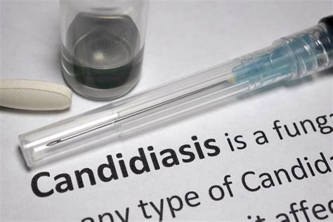 Vulvovaginal Candidiasis Discharge