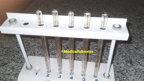 ESR Test Introduction Test Result Unit Test Method Clinical