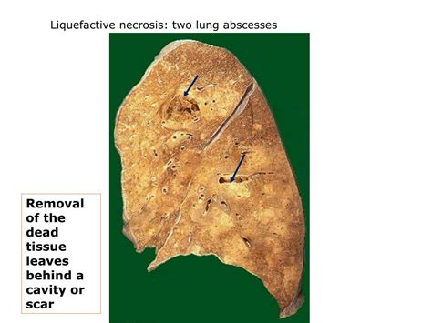 Ppt Necrosis And Apoptosis Powerpoint Presentation Free Download