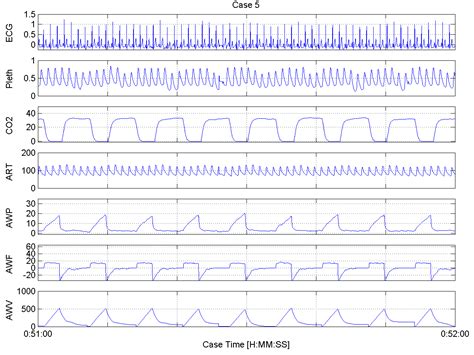 Case Waveform Plots Second Plots Case Waveform Plots Second Plots