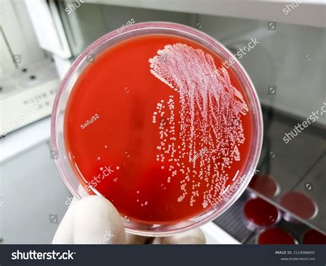 Staphylococcus Aureus Grampositive Gramvariable Nonmotile Coccus Stock