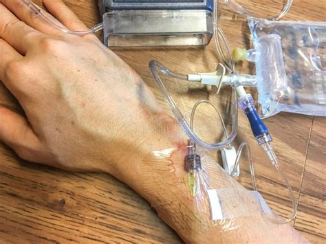 Infusion Or Iv Injection Stock Image Image Of Cure 100929671