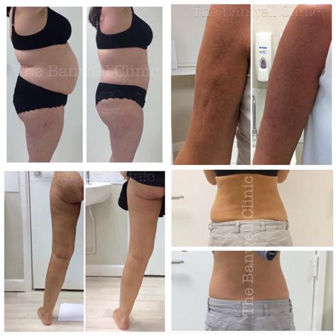 Contour Away Your Concerns The Banwell Clinic