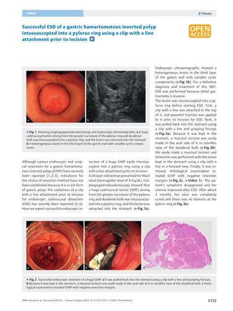Pdf Successful Esd Of A Gastric Hamartomatous Inverted Polyp Intussuscepted Into A Pylorus