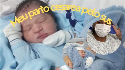 Meu parto cesárea pelo SUS meu príncipe chegou YouTube