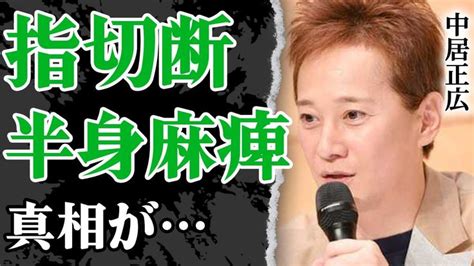 【写真あり】中居正広が指切断…半身麻痺の状態か、中居の身に起きた全貌に一同驚愕！松本の飲み会に参加バレ『まつもtoなかい』終了が決定…芸能界