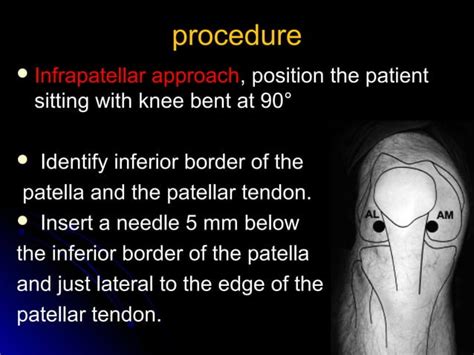 Knee Arthrocentesis Ppt