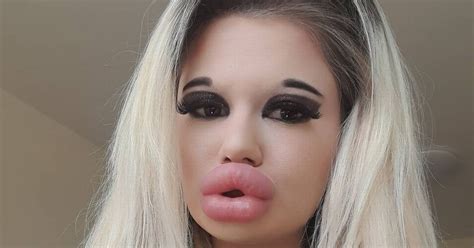 Wannabe Barbie With Worlds Biggest Lips Set For More Procedures To Enlarge Pout Daily Star