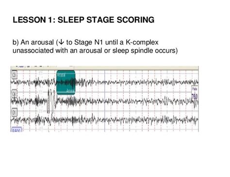 Scoring Sleep 2013 Webinar N2sleep