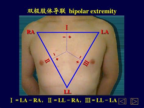 常见异常心电图学幻灯 word文档在线阅读与下载 无忧文档