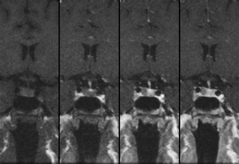 Radiology Signs Do You Know What This Sequence Is And