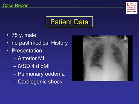 Ppt Surgically Based Device Vsd Closure Powerpoint Presentation Free